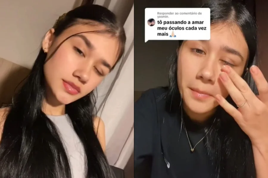 Jovem fica cega por mau uso de lente de contato