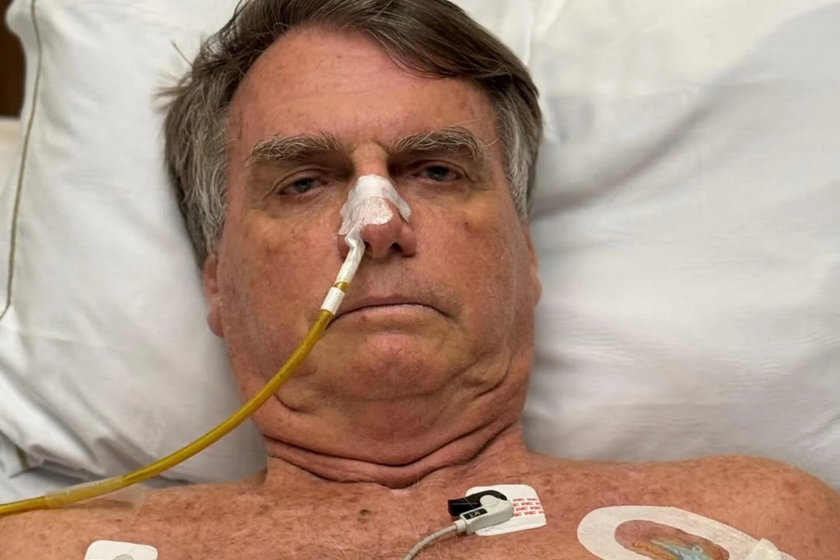 Imagem forte: Jair Bolsonaro mostra cicatriz e hematomas após cirurgia