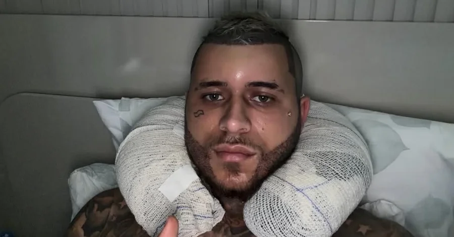 MC Pedrinho faz procedimentos cirúrgicos e surge irreconhecível